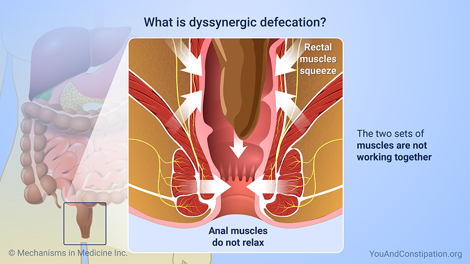 Defecation Anatomy